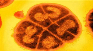 Deinococcus Radiodurans/ Conan the Bacterium | IASbaba